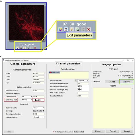 Step 13 Of The Deconvolution Process Edit Image Parameters A Open Download Scientific