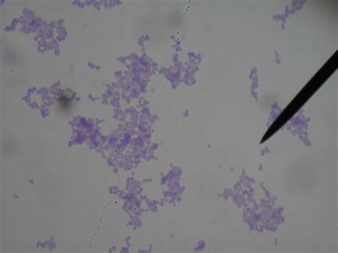 Streptococcus Pyogenes Microscopic