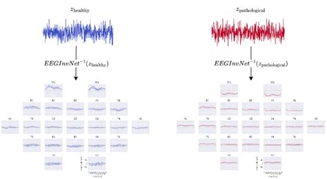 Invertible Networks Deep Learning For Brain Signal Decoding From Electroencephalography EEG