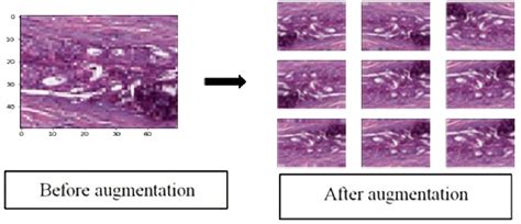 image results before and after augmentation download scientific diagram