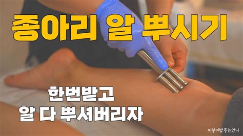종아리 알빼기 알 뿌셔버리고 종아리 미인되자 Youtube