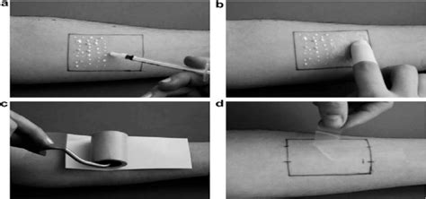 Tape Stripping Technique Method Of Tape Stripping A Application Of Download Scientific