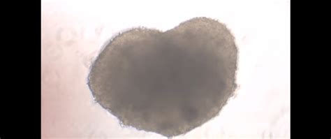 Stem Cell ‘heart Patch Moves Closer To Clinic Uw Madison News