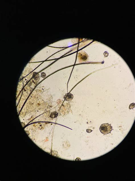 Scabies Under Microscope