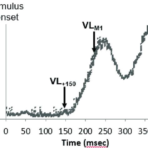 The 3 Vl Protocols Stimulation Timing Illustration Of The Stimulation