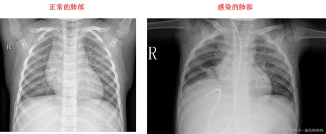 Python Resnet50 加载预训练 Resnet预训练模型pytorchmob6454cc6cee7e的技术博客51cto博客