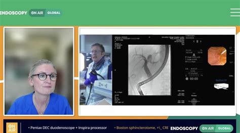 George Webster On Linkedin Delighted To Be Involved In Endoscopy On Air Global Event New Idec…