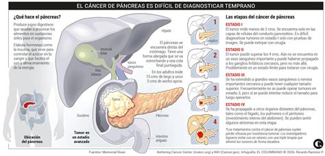 ¿cura Para El Cáncer De Páncreas Oncólogos Lograron Eliminar Tumores