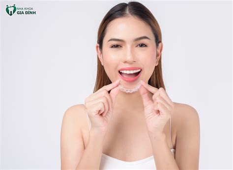 Niềng Răng Trong Suốt Hiệu Quả Như Thế Nào Chi Phí Bao Nhiêu