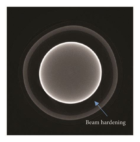 A Ct Raw Data Image And B Ct Slice After Using Edge Preserving