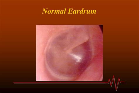 Ppt Comprehensive Introduction To History And Physical Exam