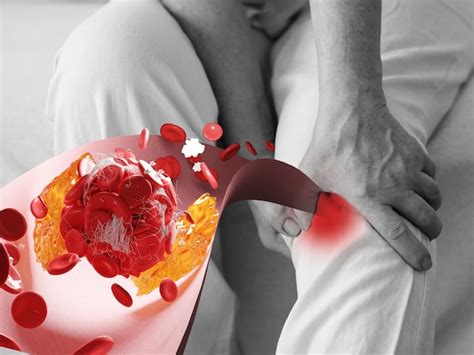 Images De Rectocolite Hemorragique Téléchargement Gratuit Sur Freepik