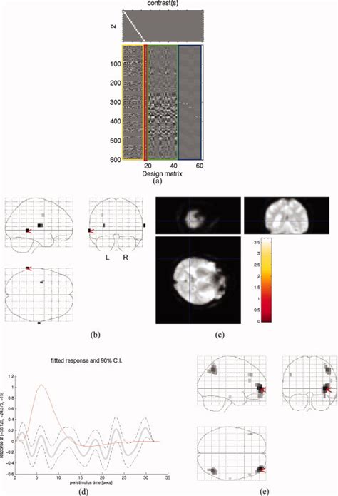 Case No 1 A Illustration Of Design Matrix Showing The Nested Model Download Scientific
