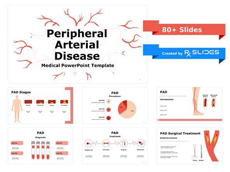 Download Peripheral Arterial Disease Powerpoint Template Rxslides