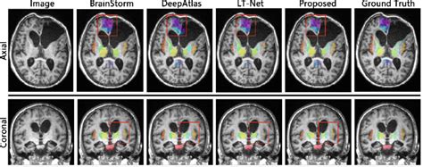 Visual Comparison Of Different Segmentation Methods Color Figure Online Download Scientific