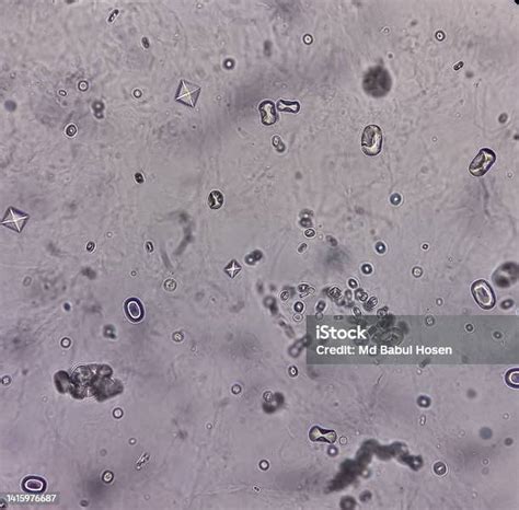 Gambar Mikroskopis Menunjukkan Kristal Kalsium Oksalat Dari Sedimen