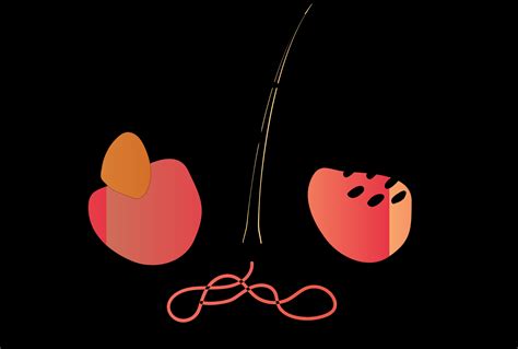 Deciphering Abscesses Types Prevention And Treatment Insights