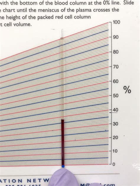 What Is Hematocrit Quizlet At Imogen Parry Okeden Blog