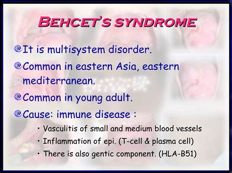 Oral Medicine Case Behcet Disease Ppt