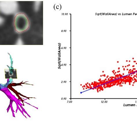 A Segmented Airway Tree Including Labeling Of The Pulmonary Lobes Download Scientific