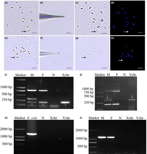 Isolation And Identification Of Sex Chromosomes Of Spinacia Oleracea L Download Scientific