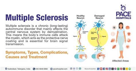 Disseminated Sclerosis Causes Symptoms Treatment Multiple Sclerosis