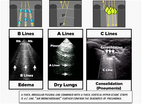 Thoracic And Other Images Critical Care Northampton