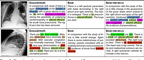 Figure 5 From Generating Radiology Reports Via Memory Driven Transformer Semantic Scholar