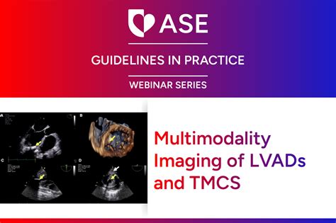 Guidelines In Practice Webinar Series Multimodality Imaging Of Lvads