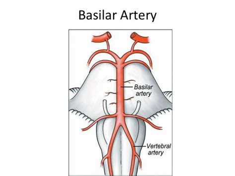 Basilar Artery Occlusion