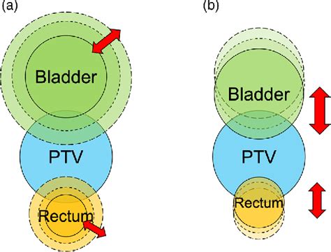 Figure 2 From A New Predictive Parameter For Dose‐volume Metrics In