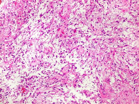 Neupatimagem Unicamp