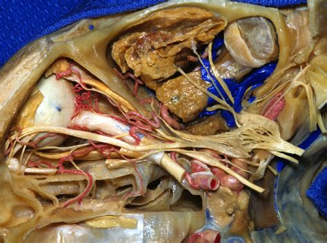 Orbit And Infratemporal Fossa Neuroanatomy The Neurosurgical Atlas