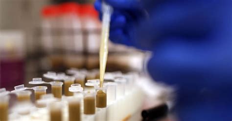 IBS Treatment Gold Coast Naturopath Gold Coast Health Challenges