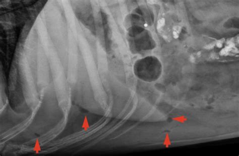 Abdomen → Peritoneum And Retroperitoneum Flashcards Quizlet