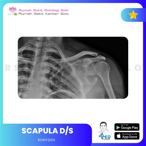 Rontgen Scapula Ds