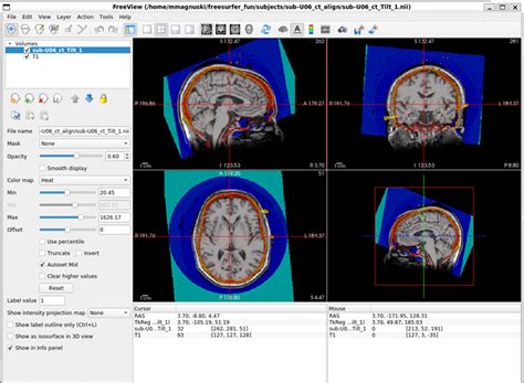 incorrect lta affine from pre alignment during mri ct coregistration