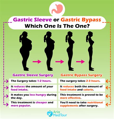 Gastric Bypass Vs Gastric Sleeve A Close Comparison Ariamedtour