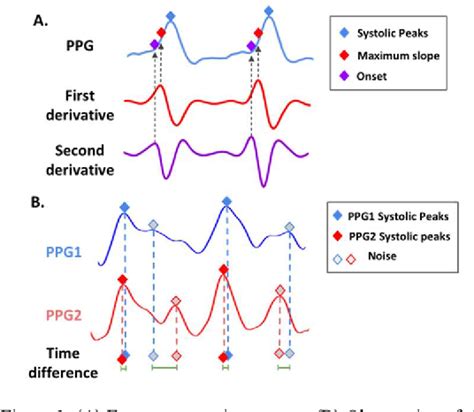 Figure 1 From A Graph Based Method For Interbeat Interval And Heart Rate Variability Estimation