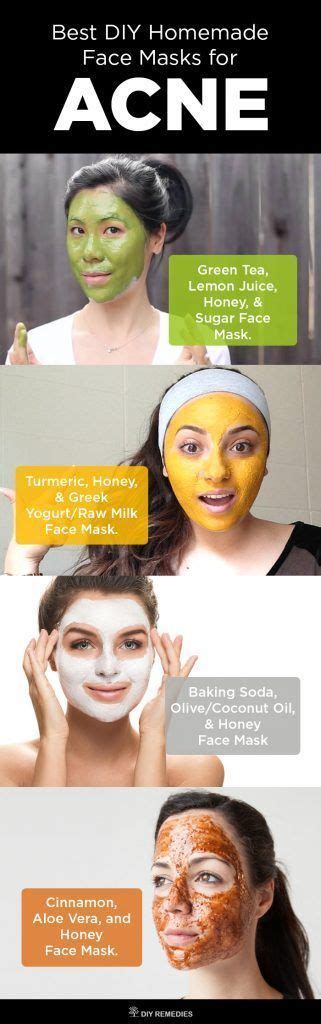 6 Best Diy Homemade Face Masks For Acne Acne Face Mask Face Acne