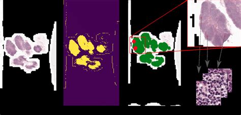 Patch Extraction Process A Whole Slide Image B Segmented Tissue