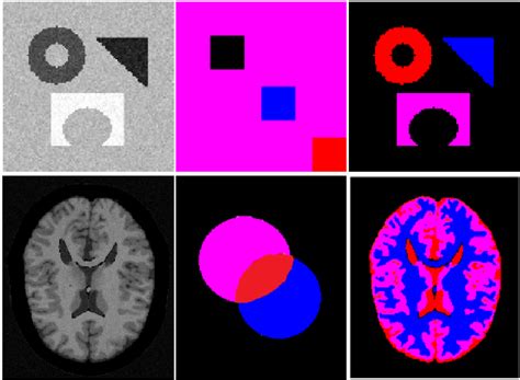 Segmentation Results From The Convex Multi Phase Segmentation Download Scientific Diagram