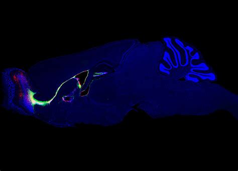 Biocanvas A Sagittal Cut Of The Mouse Brain Visualized With