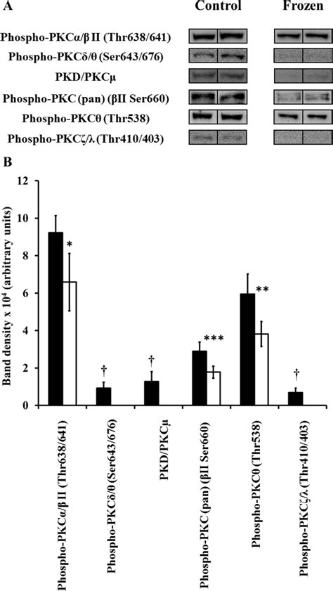 Protein Kinase C In The Wood Frog Rana Sylvatica Reassessing The Tissue Specific Regulation Of
