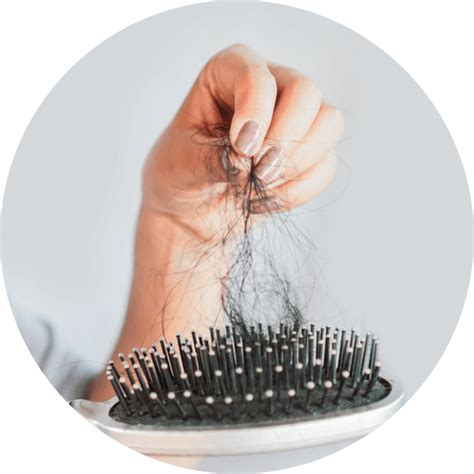 Try Our Scalp Quiz Nizoral