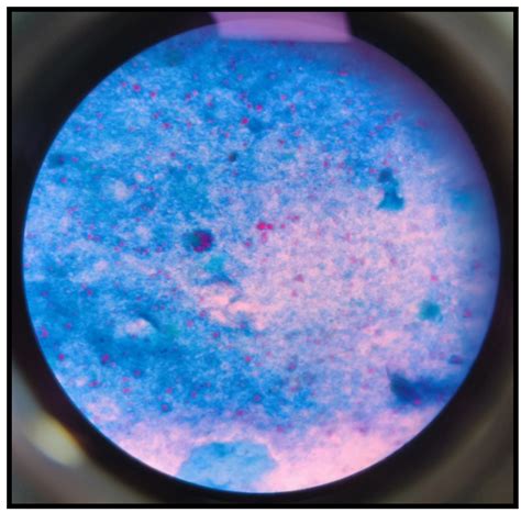 Showing Acid Fast Oocysts Of Cryptosporidium Spp In Kinyouns Acid Fast