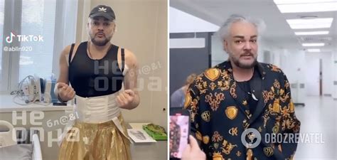 Які пластичні операції робив Кіркоров як він виглядає зараз і до операцій фото Oboz Ua