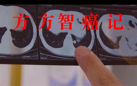 肺癌果酱色痰的图片 肺癌血痰图片 伤感说说吧