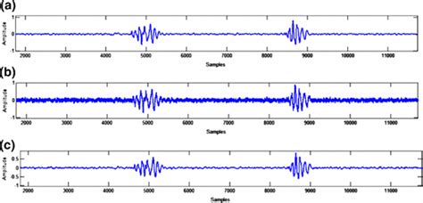 Denoising Of Pcg Signal Using Db10 Wavelets At 4th Level With Soft Download Scientific Diagram