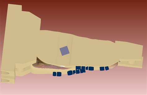 Stl File Digital Quadrant Model With Orbix W Pins Articulator Interfaces 🥼 Obj And 3mf ・3d